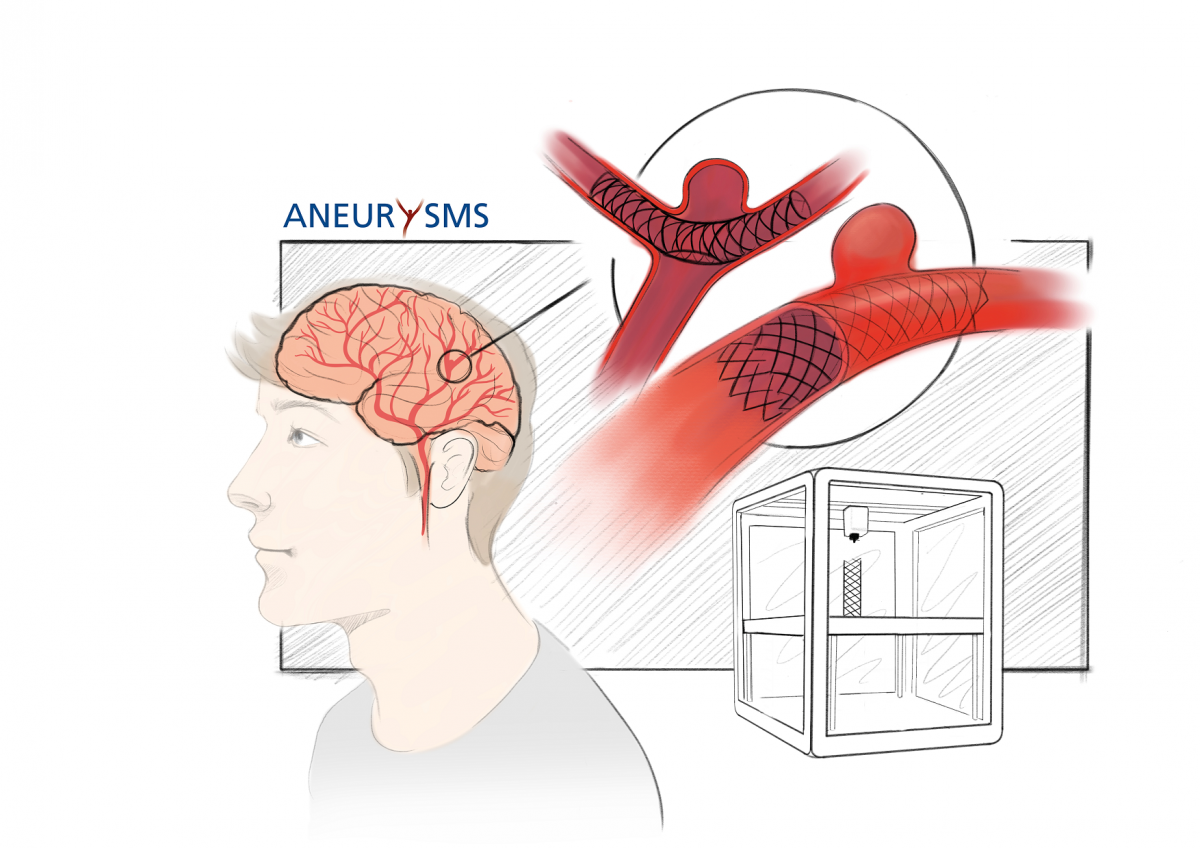 Aneurysms - Else Kröner Fresenius Center for Digital Health