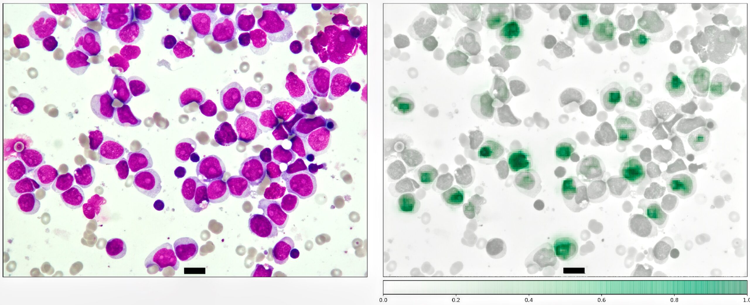 MAINFRAME - Else Kröner Fresenius Center for Digital Health